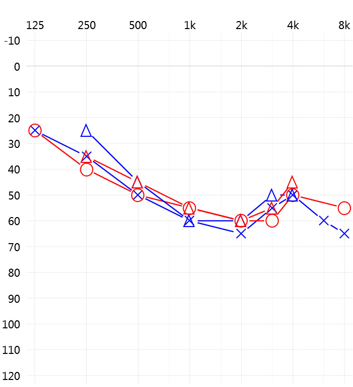 КСВП на тональные посылки - Статья - Медицинский центр МастерСлух